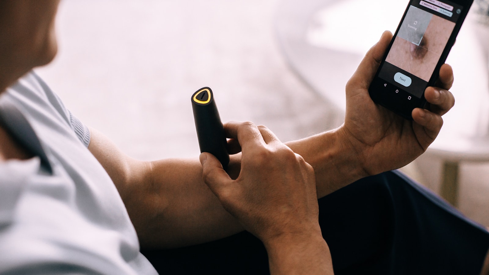 NOTA mole tracker can easily detect the pathology of a mole in as ...