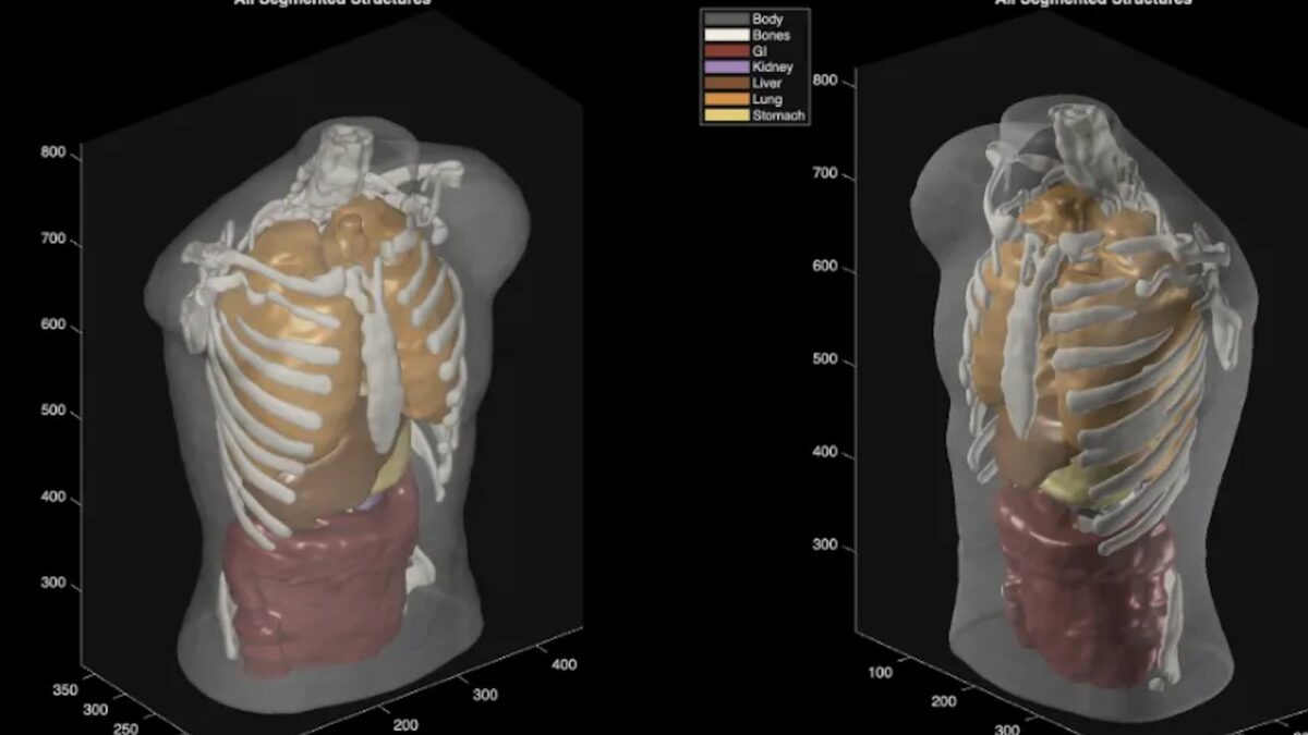 Midjourney Scanner: AI’s Next Big Move Into Preventive Healthcare